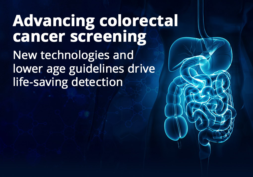 Advancing colorectal cancer screening: new technologies and lower age ...